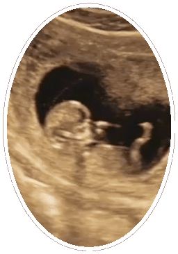 Pro-Mama. Pro-Baby. Pro-Life. – We Heart Nutrition®