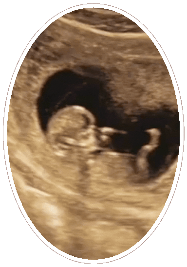 Pro-Mama. Pro-Baby. Pro-Life. – We Heart Nutrition®