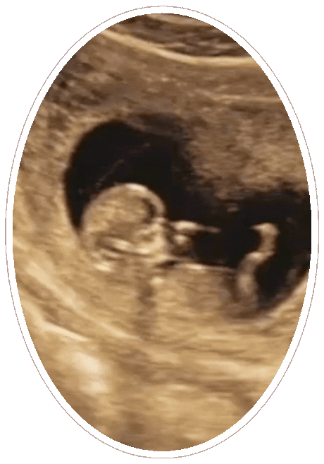 Pro-Mama. Pro-Baby. Pro-Life. – We Heart Nutrition®